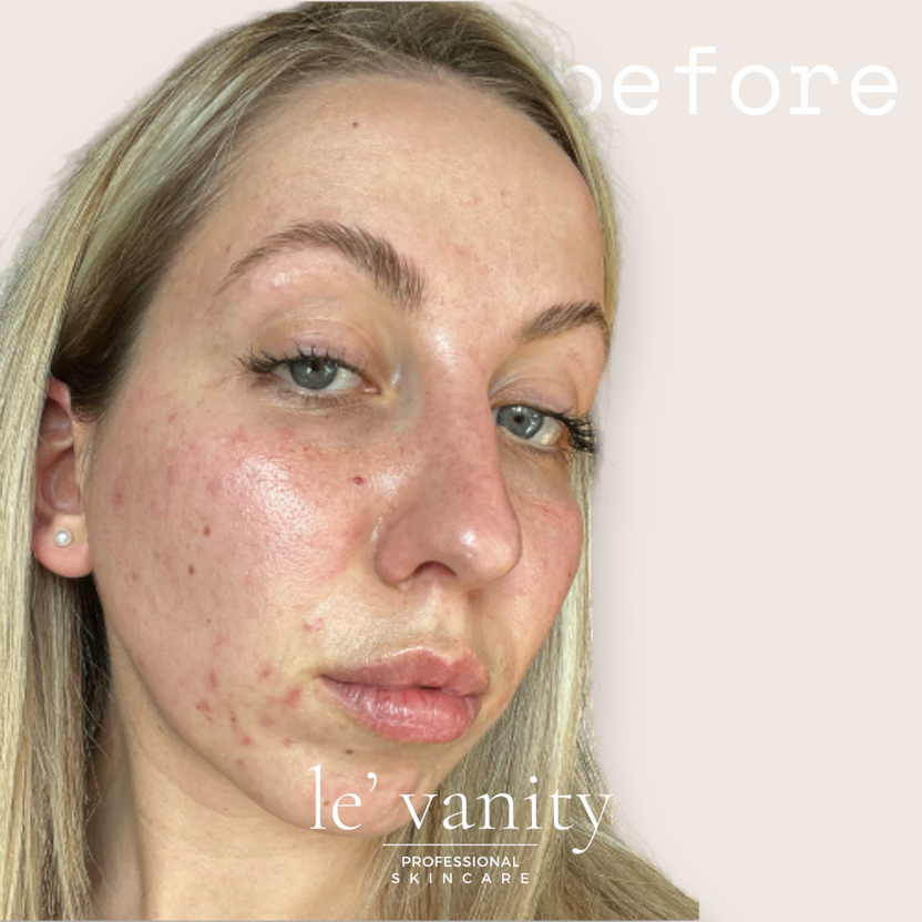 le' bio-collagen real deep mask – le' vanity